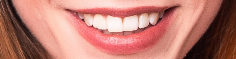 Design Your Smile - Alexandra Dental - Dublin, Limerick, Shannon ...